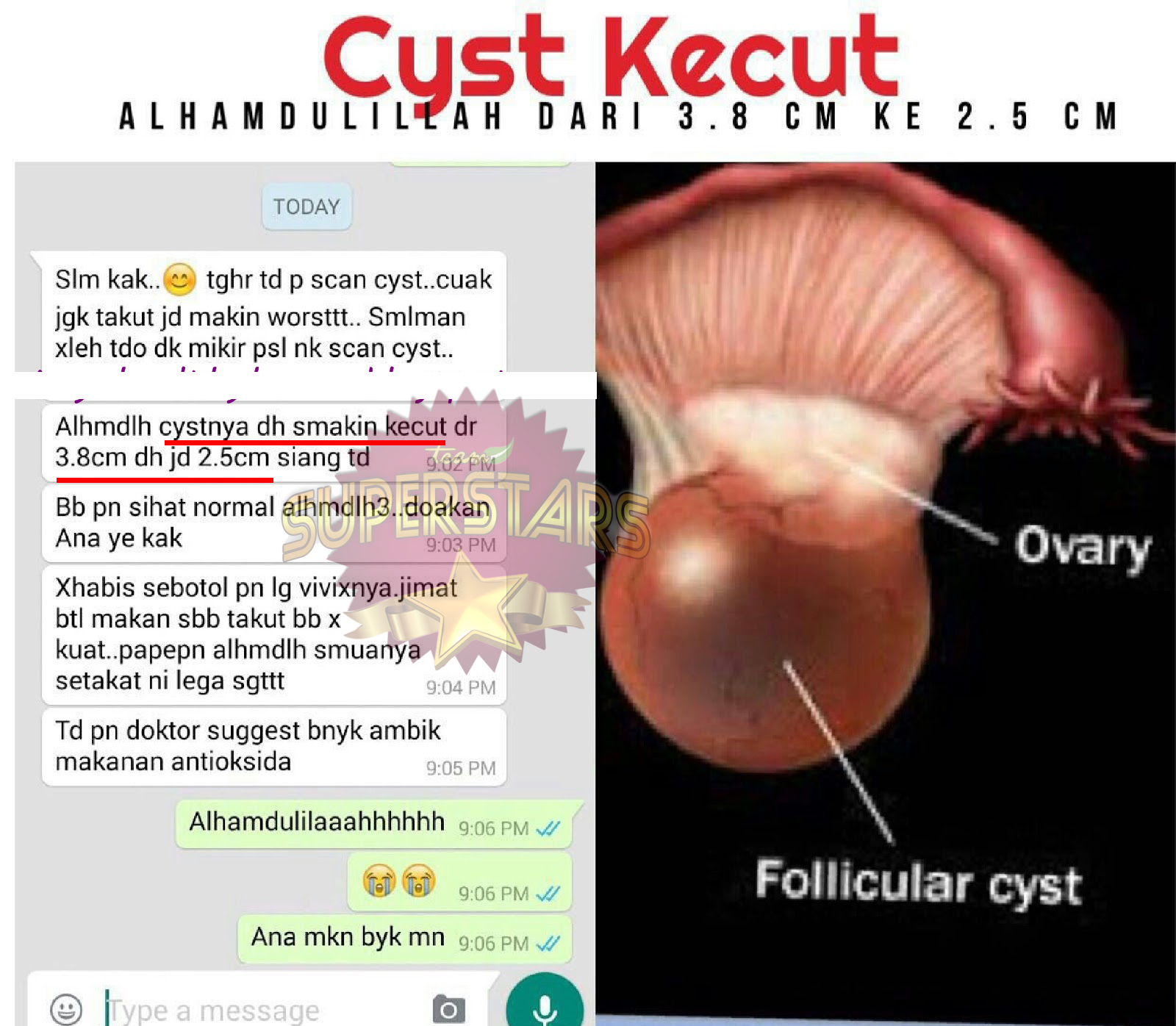 Penawar cyst | Pengedar Shaklee | Stokis Shaklee | Vivix Shaklee